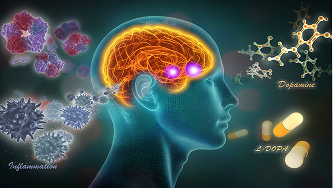 What disease is L-DOPA used to treat? - Kintai